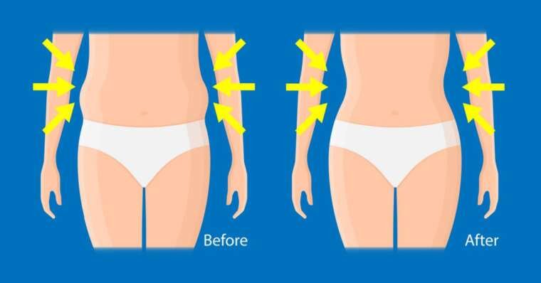 What To Expect Before, During, and After CoolSculpting: A Comprehensive ...
